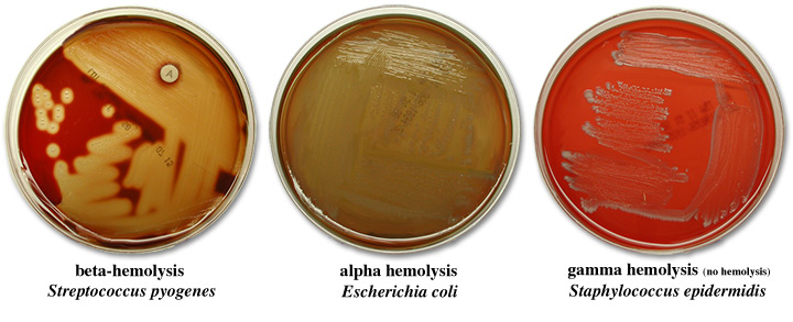 Beta, alpha, and gamma hemolysis | Microbiology, Medical laboratory ...